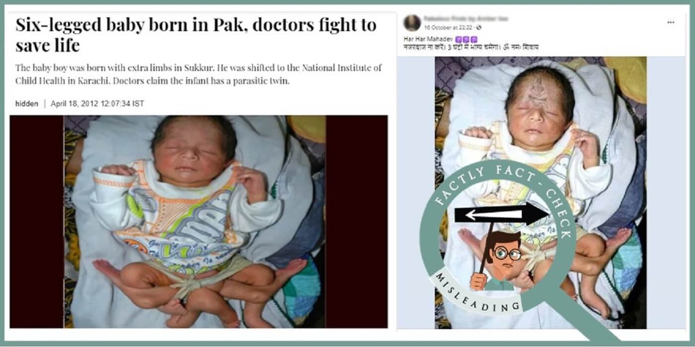 Humans With Extra Limbs