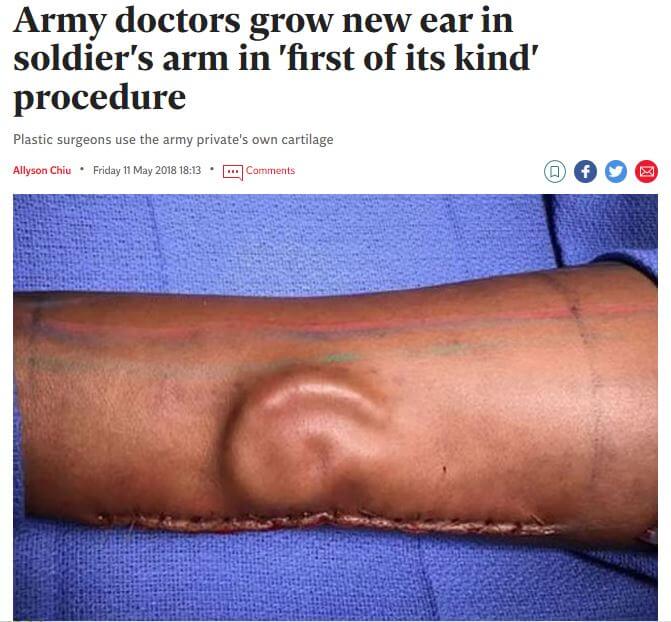 This photo does not show US army soldier who had undergone an ear ...