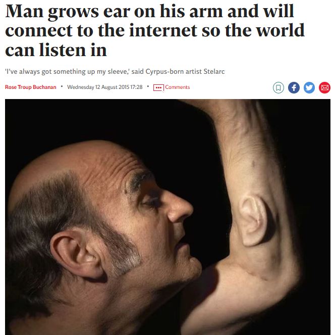 This photo does not show US army soldier who had undergone an ear ...