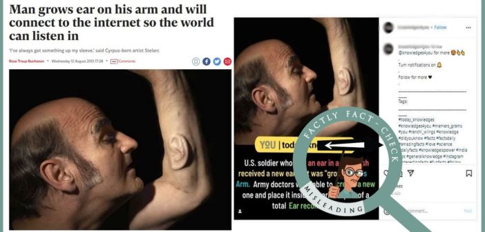 This photo does not show US army soldier who had undergone an ear ...