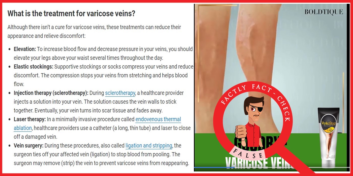 There is no Research to support the effectiveness of ‘Variko stop ...