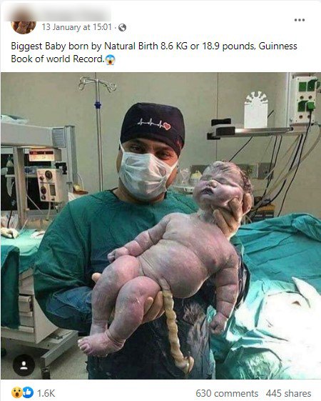 This viral photo does not show the world's heaviest baby - FACTLY