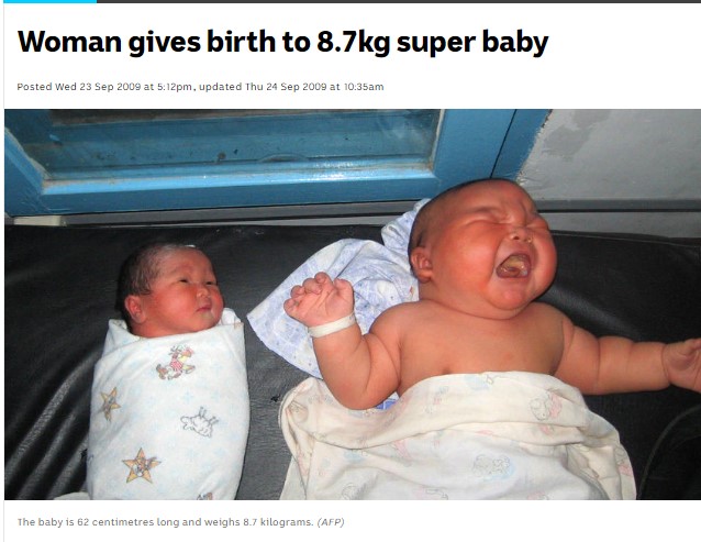 Worlds Biggest Baby Parents Welcome 14 Pound Baby, Biggest Baby On